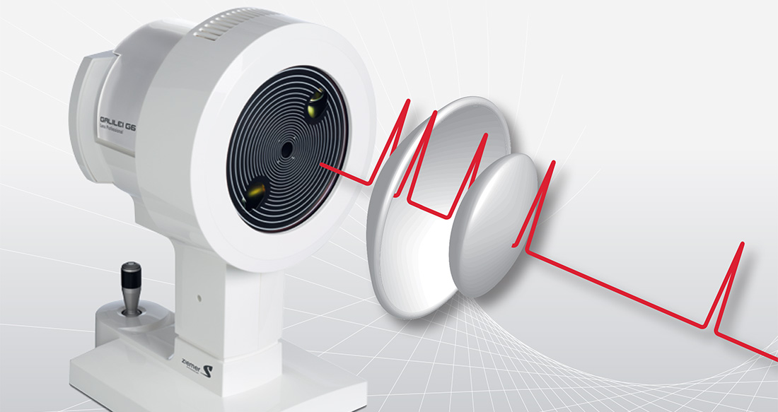 Biometria por Interferometria - Signorelli Oftalmologia