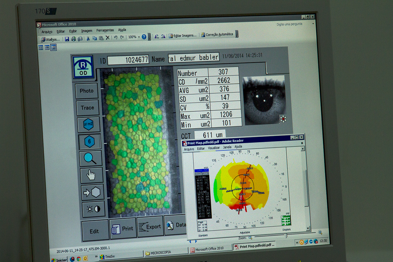 Microscopia Especular de Córnea - Signorelli Oftalmologia